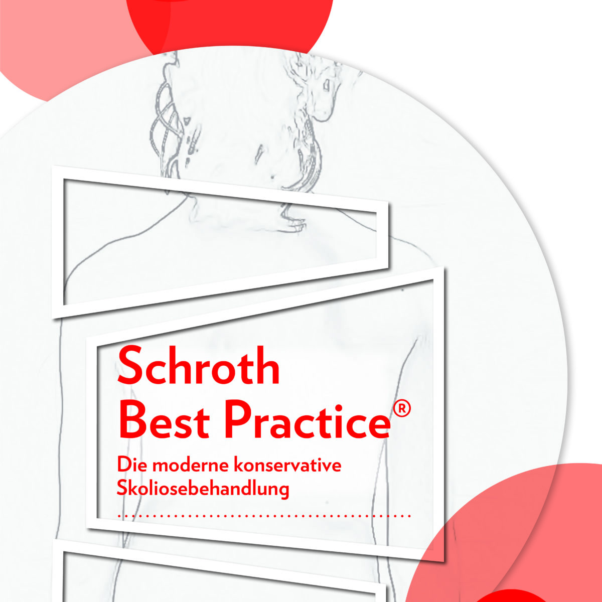 Schroth Best Practice®: Die moderne konservative Skoliosebehandlung ...